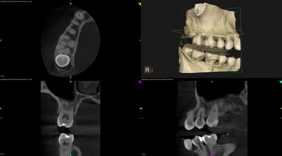 Services - Museum District Endodontics